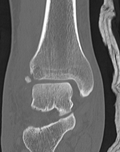 techniques | The Bone School